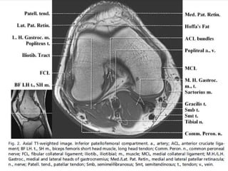 Knee mri: systematic interpretation by dr. d. p. swami | PPTX | Death, Injury, or Military ...