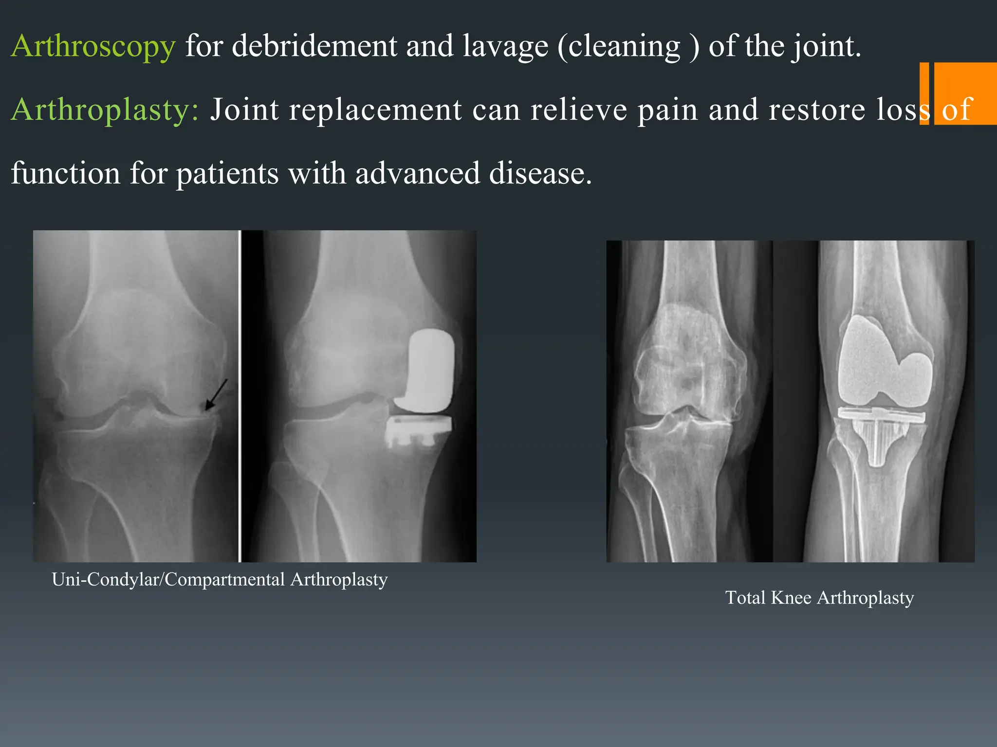 KNEE OSTEOARTHRITIS 2020-2021 orthopaedic rehabilitation.pdf