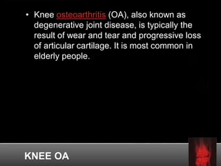 kneeosteoarthritisitsphysiotherapeuticapproaches-210113081217.pdf