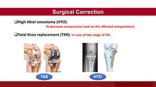 Knee osteoarthritis treatment in 2019 | PPTX