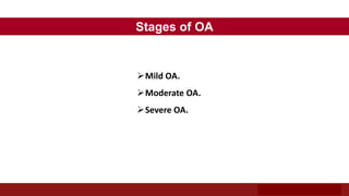 Knee osteoarthritis treatment in 2019 | PPTX