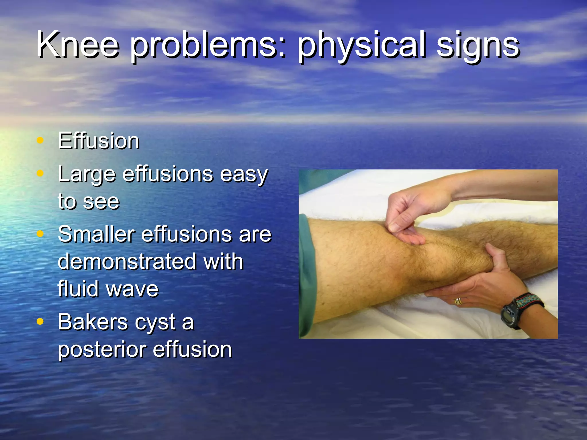 Knee pain | PDF