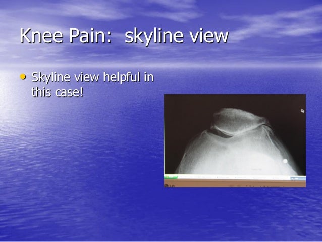 Knee pain