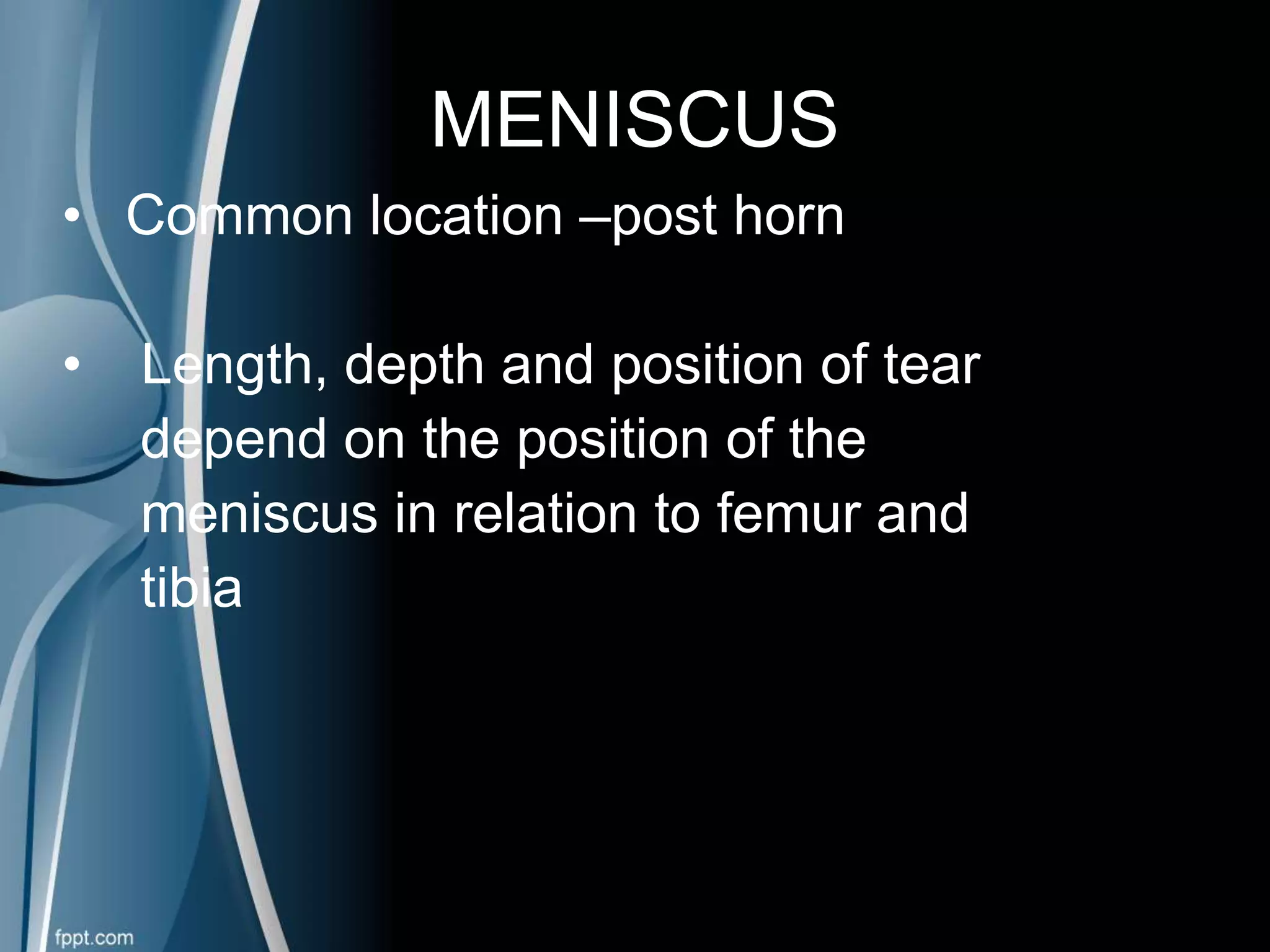 Meniscal Injuries | PPTX