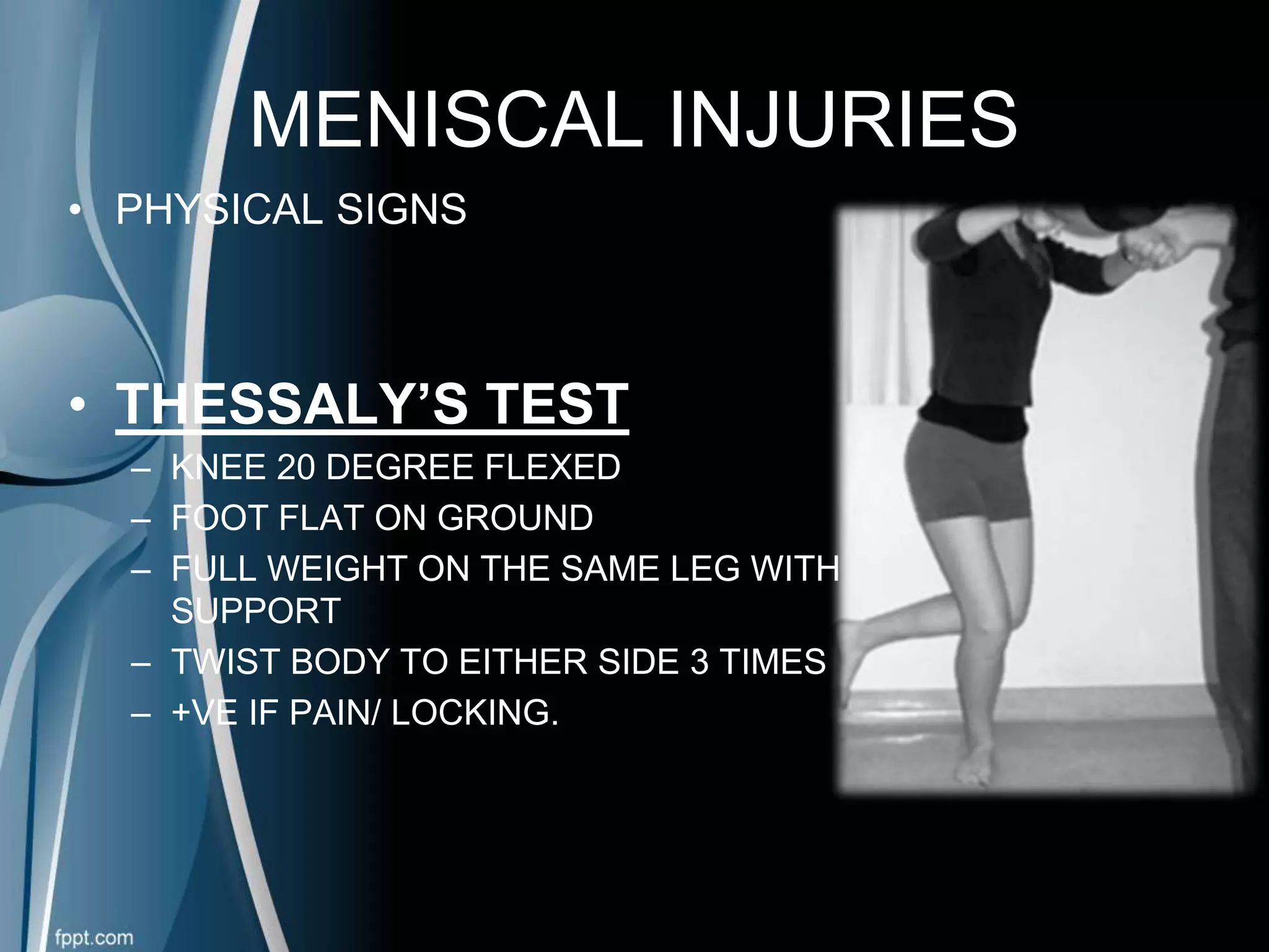 Meniscal Injuries | PPTX