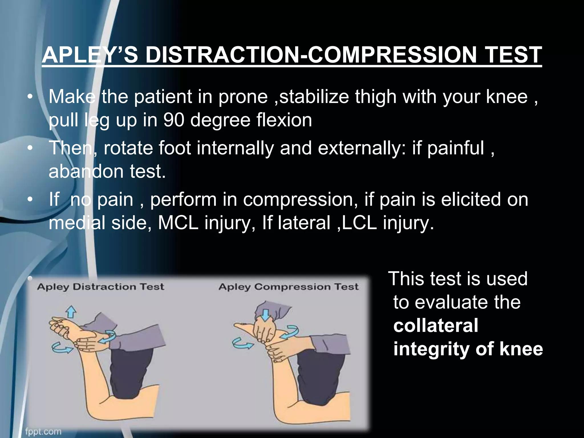 Meniscal Injuries | PPTX