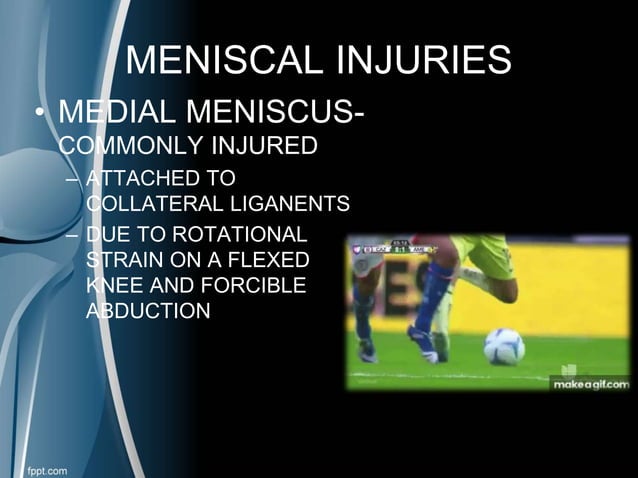 Meniscal Injuries | PPTX | Death, Injury, or Military Conflict ...