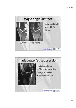 Knee MRI pitfalls | PDF | Death, Injury, or Military Conflict ...
