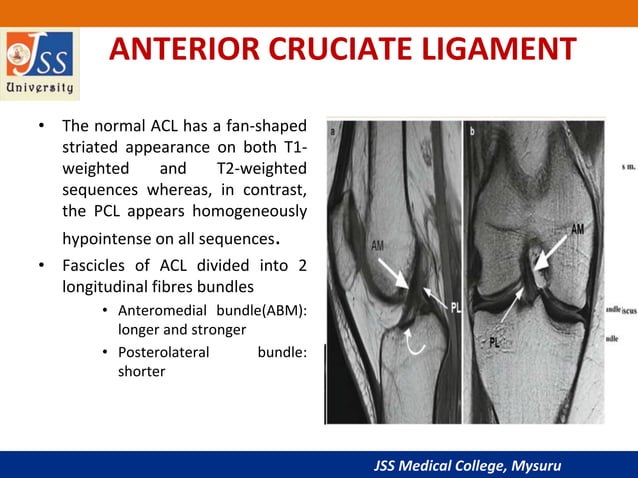 MRI KNEE.pptx