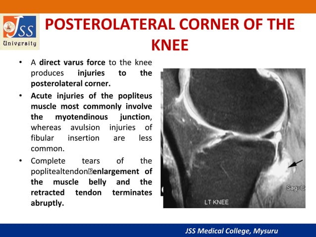 MRI KNEE.pptx