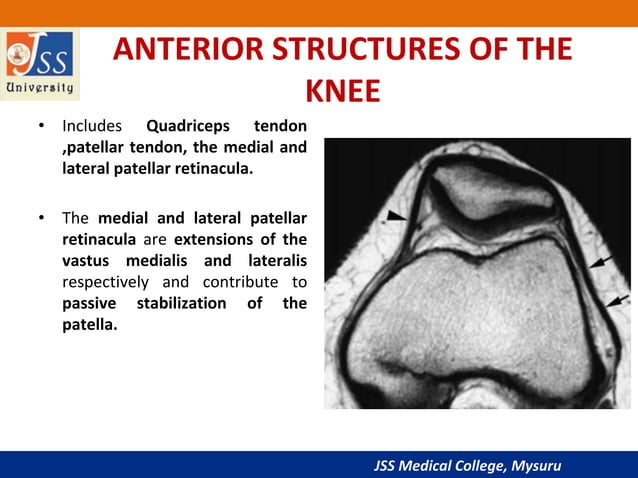 MRI KNEE.pptx
