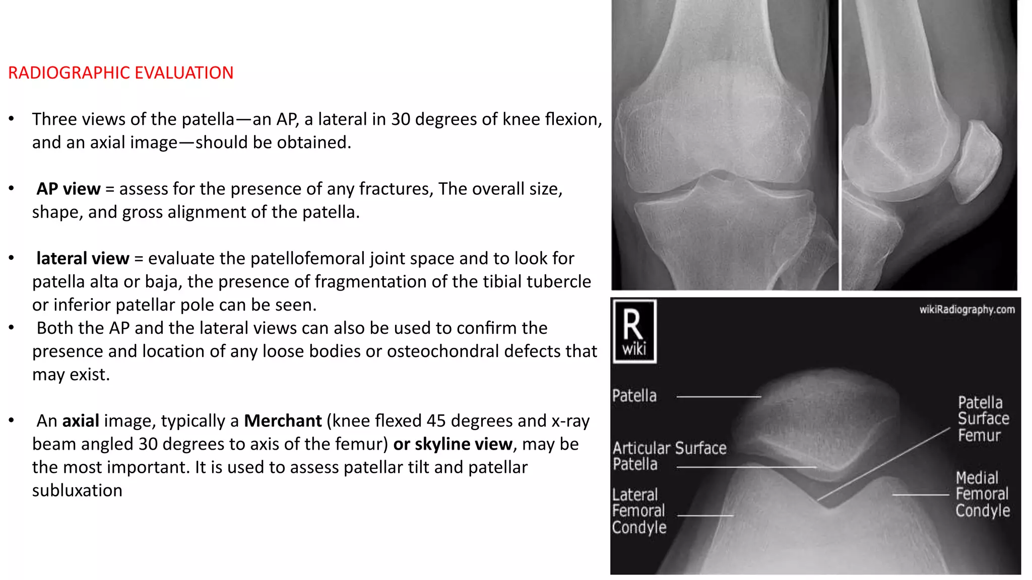 BIOMECHANICS & PATHOMECHANICS OF KNEE JOINT AND PATELLOFEMORAL JOINT | PPTX