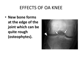 Knee problems & physiotherapy (kunjal shah) | PPTX