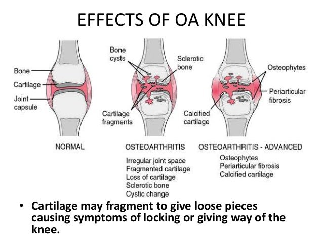 Knee problems & physiotherapy (kunjal shah)