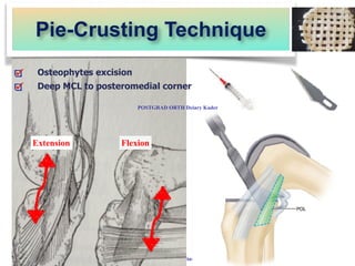Knee recon 2018 deiary kader post grad | PPT