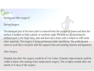 Knee replacement | ODP | Surgery | Medical Health