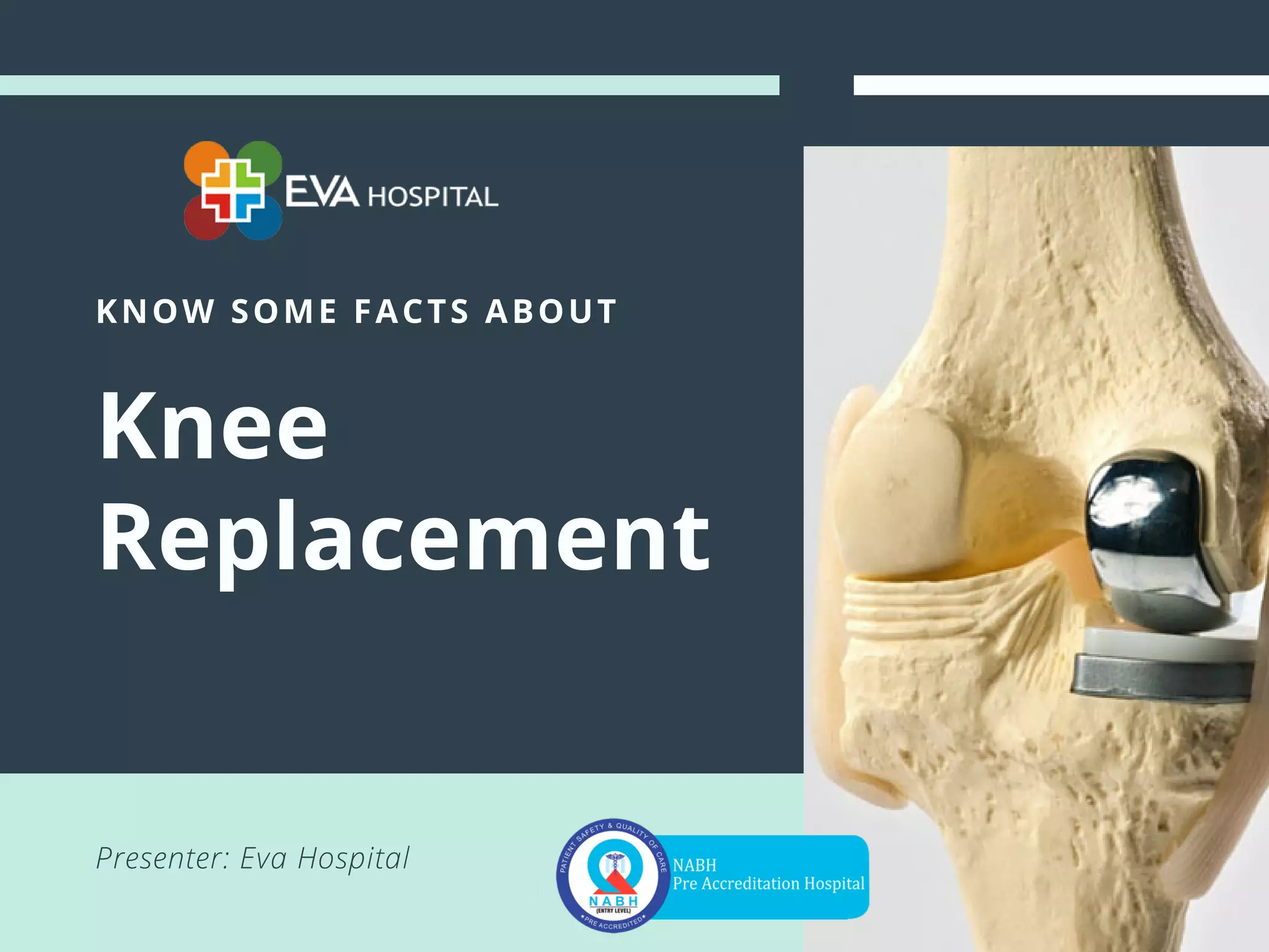 Eva Hospital - Know Some Facts About Knee Repalcement | PDF