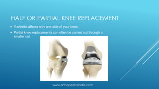 Knee replacement in aurangabad | PPTX