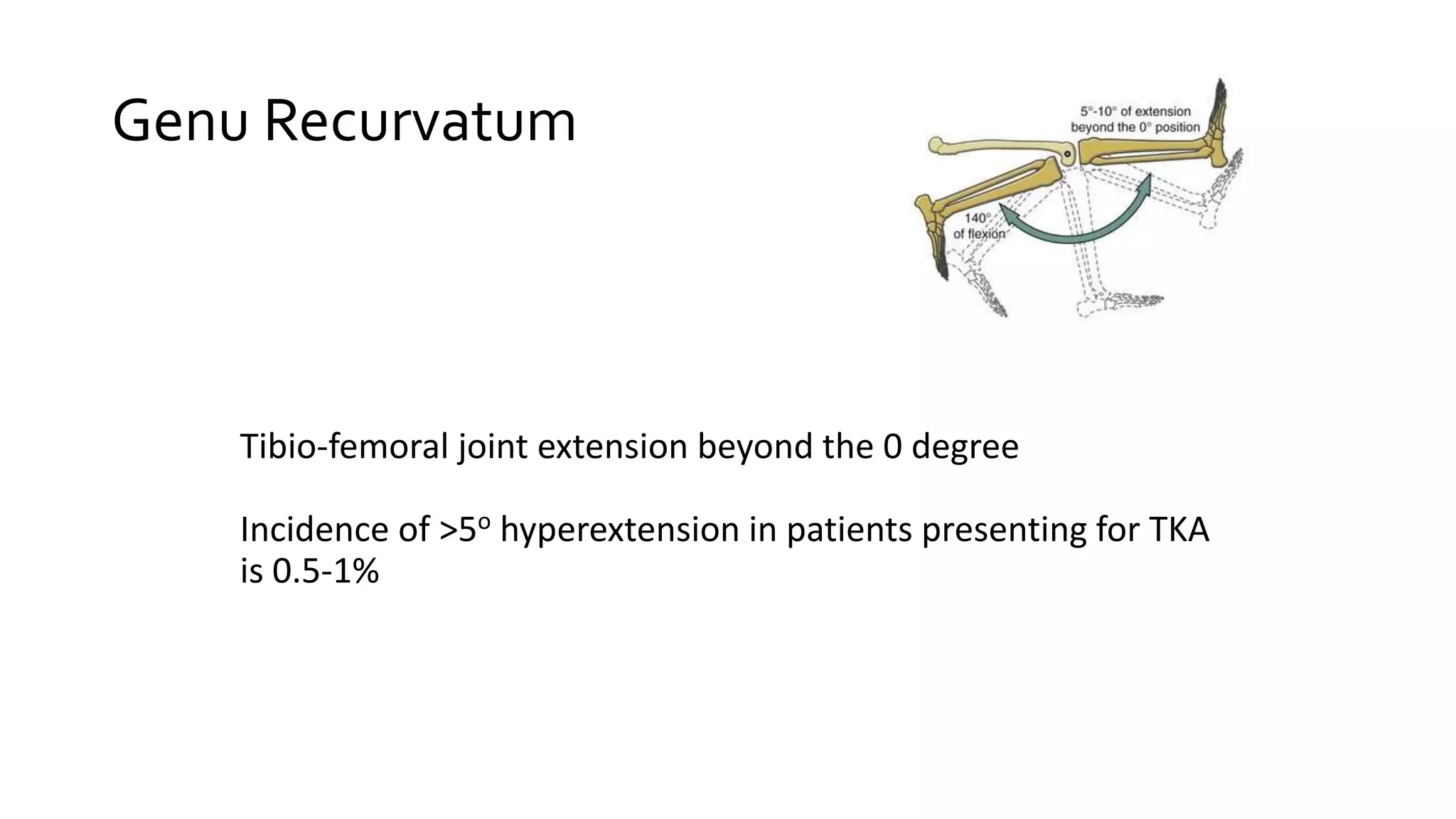 KNEE REPLACEMENT IN RECURVATUM KNEE.pptx