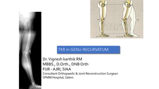 Congenital Genu Recurvatum