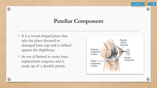 What is Knee Replacement Surgery | MedMonks | PPT