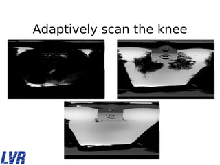Knee scan | PPT