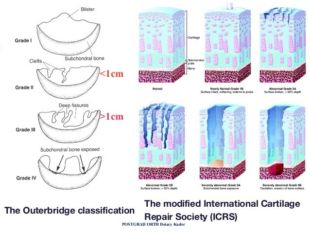Knee soft tissue postgraduate orthopaedic 2016