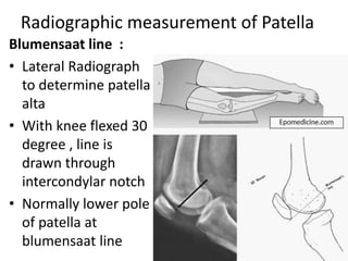 Knee joint xray views | PPTX