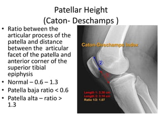 Knee joint xray views | PPTX