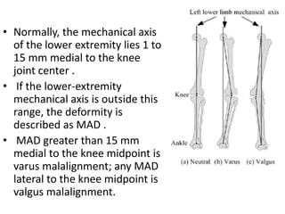 Knee joint xray views | PPTX