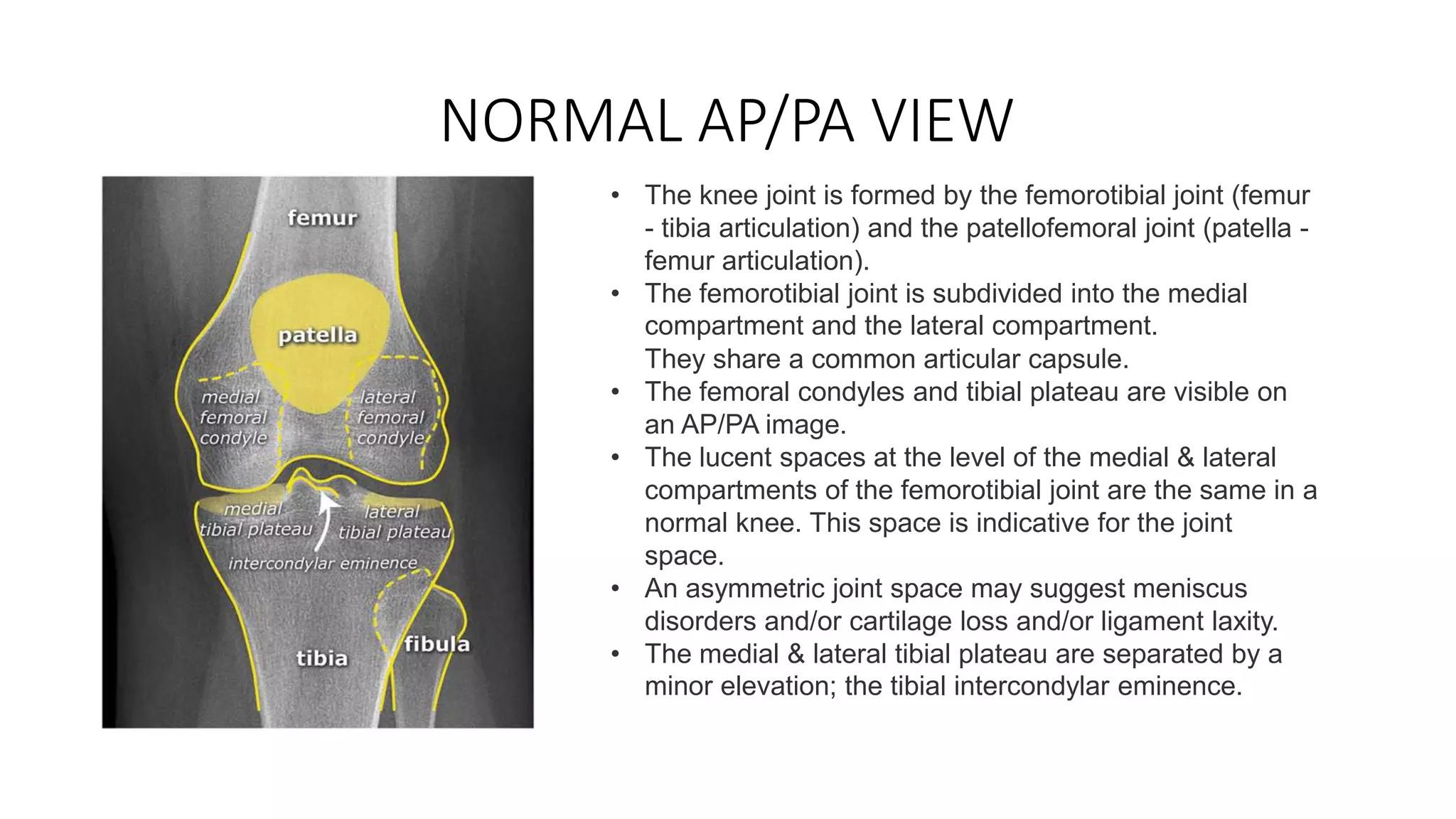 X Ray and MRI of Knee Joint | PPTX
