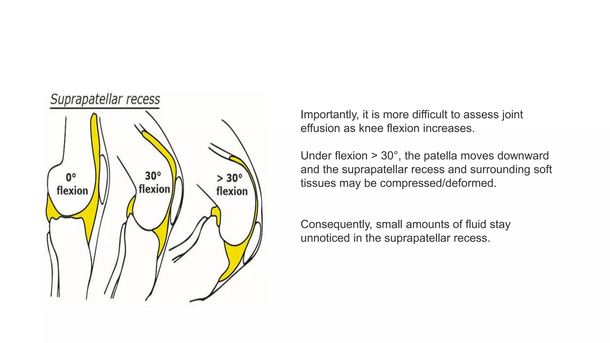 X Ray and MRI of Knee Joint | PPTX