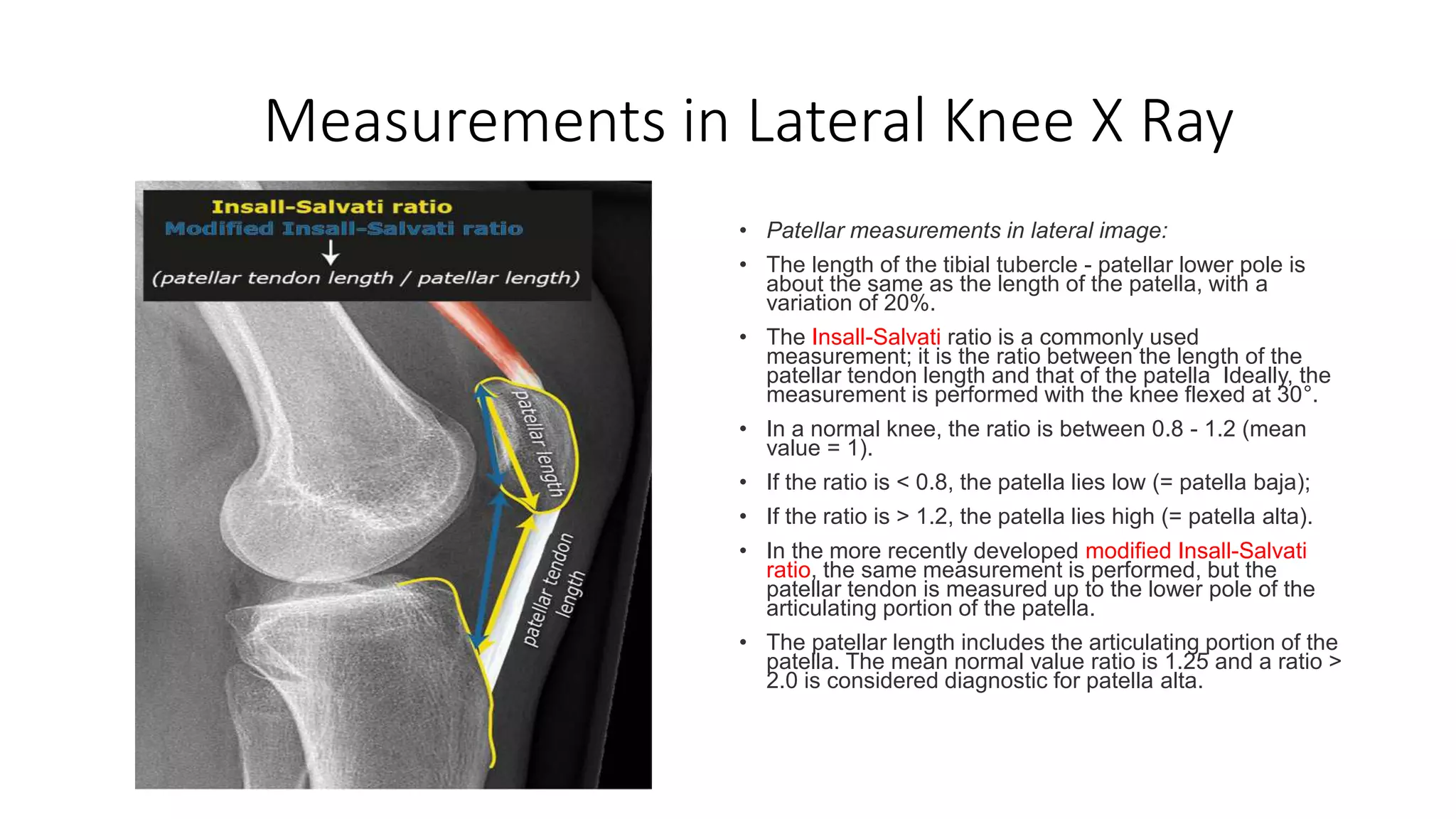 X Ray and MRI of Knee Joint | PPTX