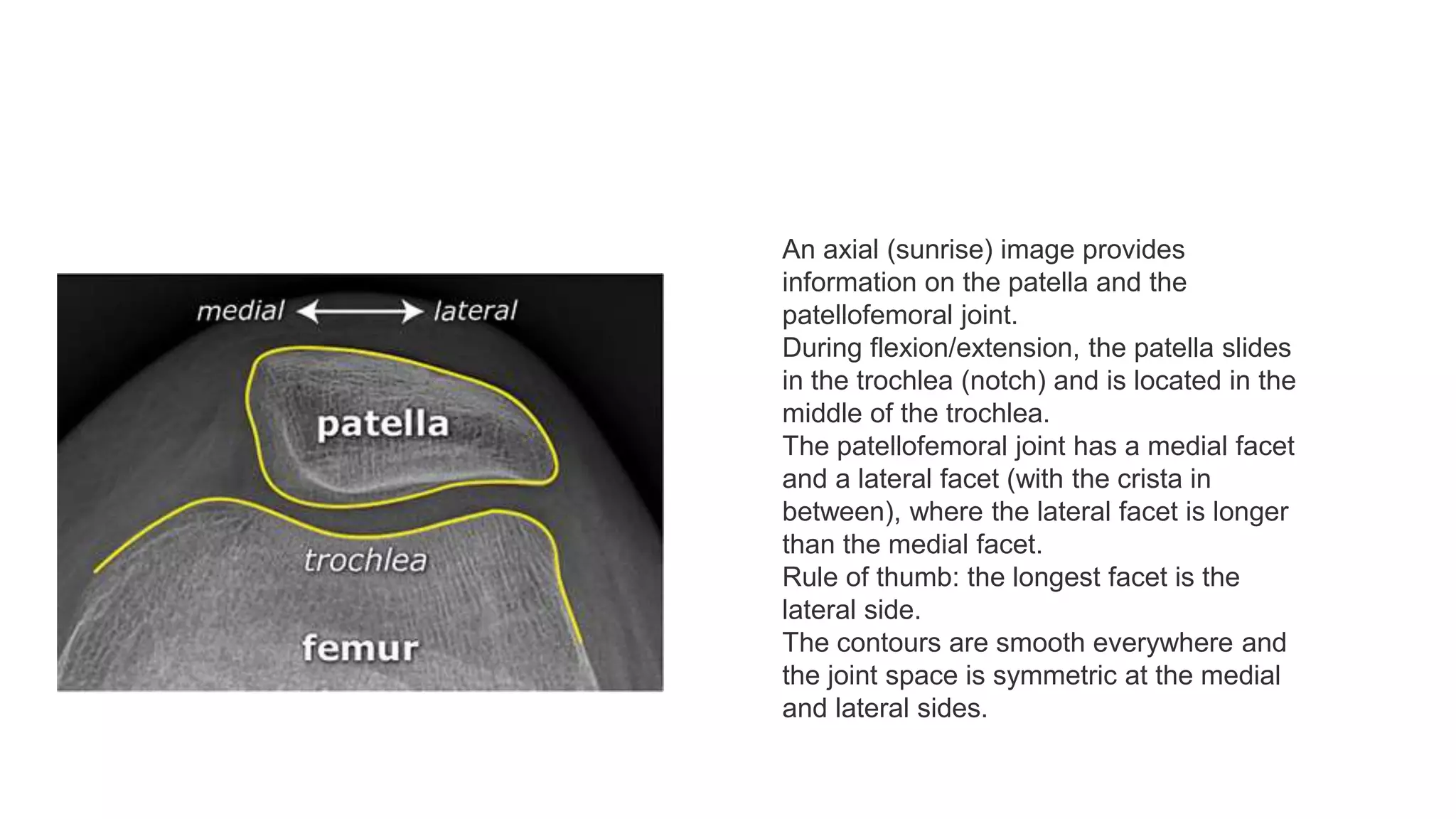 X Ray and MRI of Knee Joint | PPTX