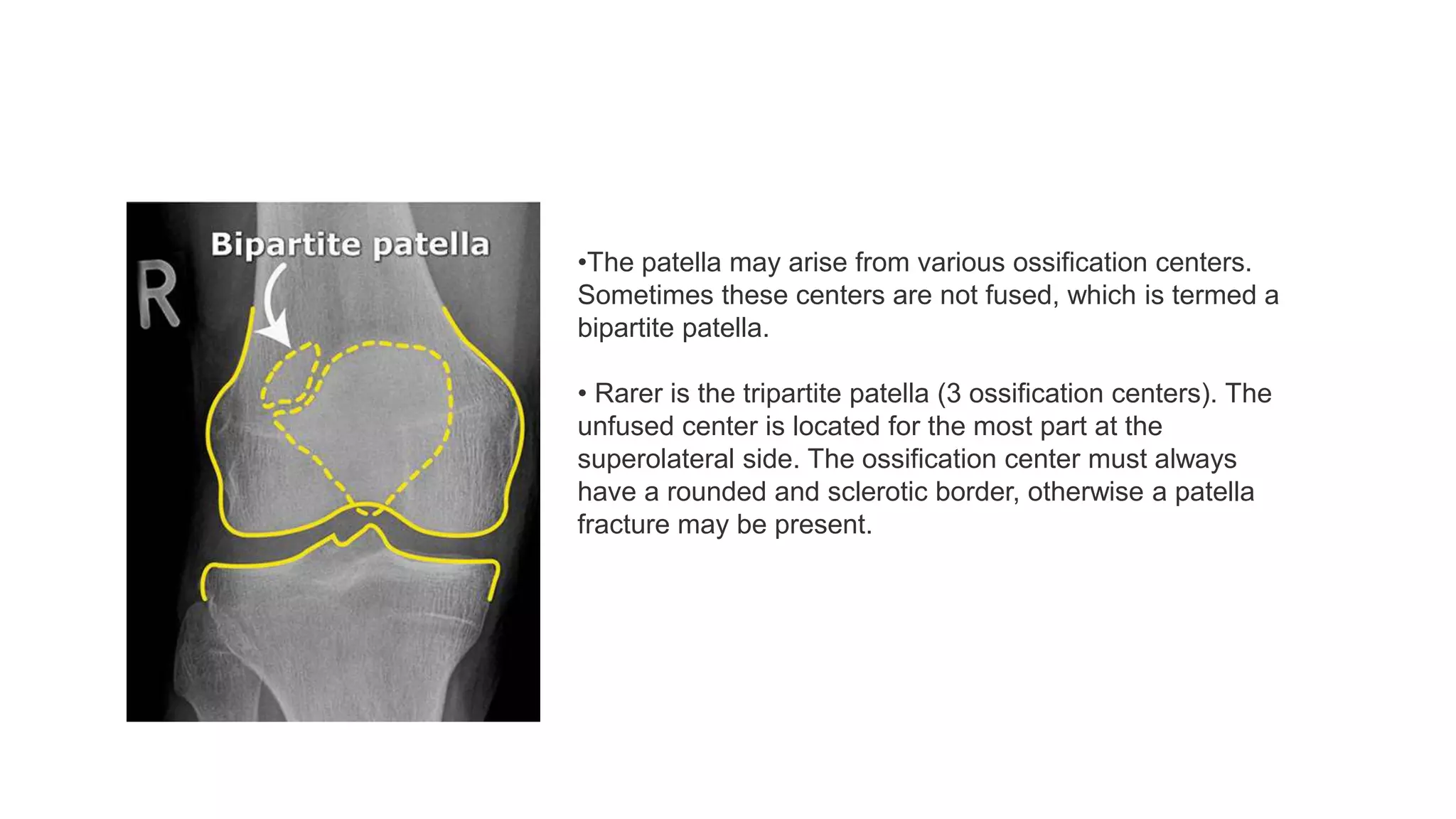 X Ray and MRI of Knee Joint | PPTX