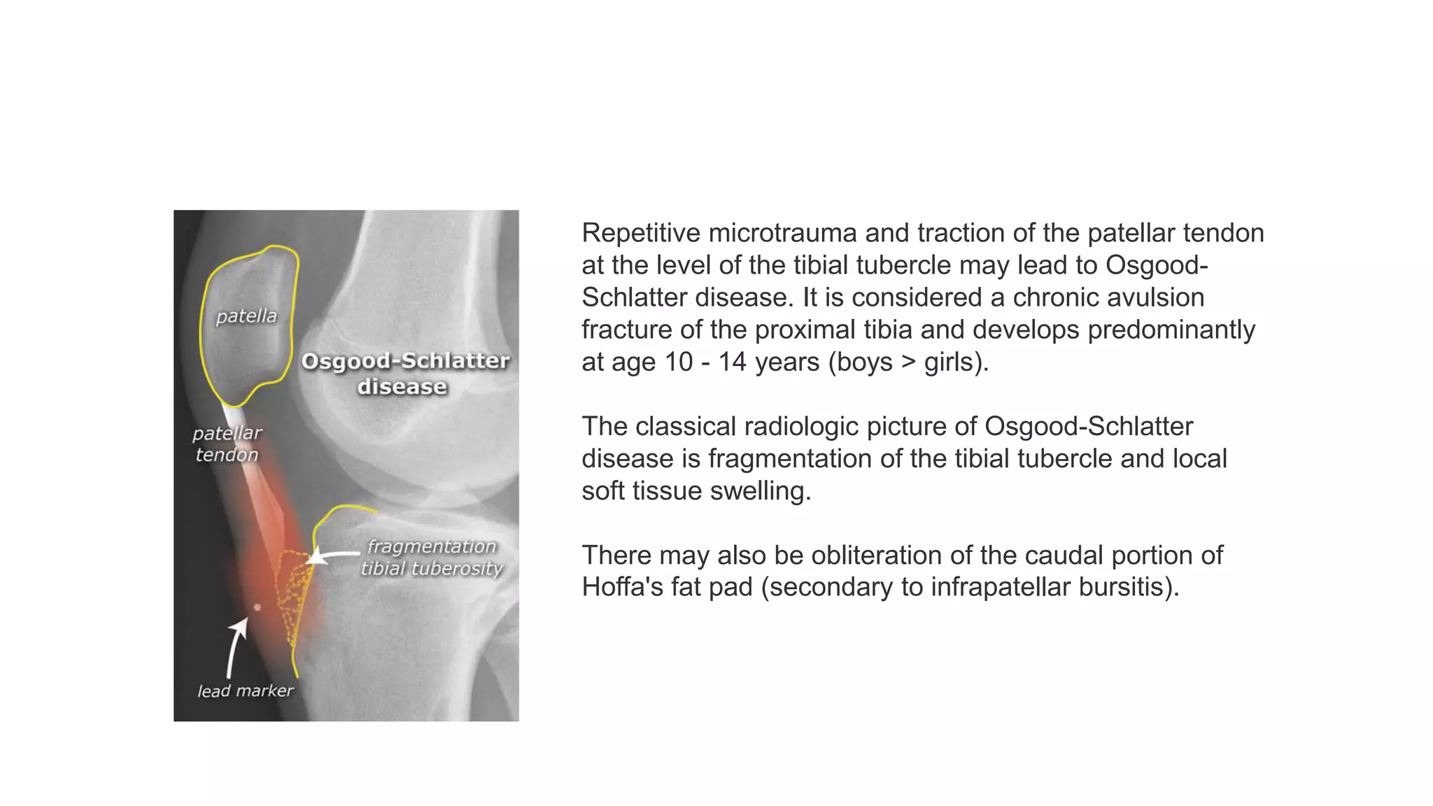 X Ray and MRI of Knee Joint | PPTX