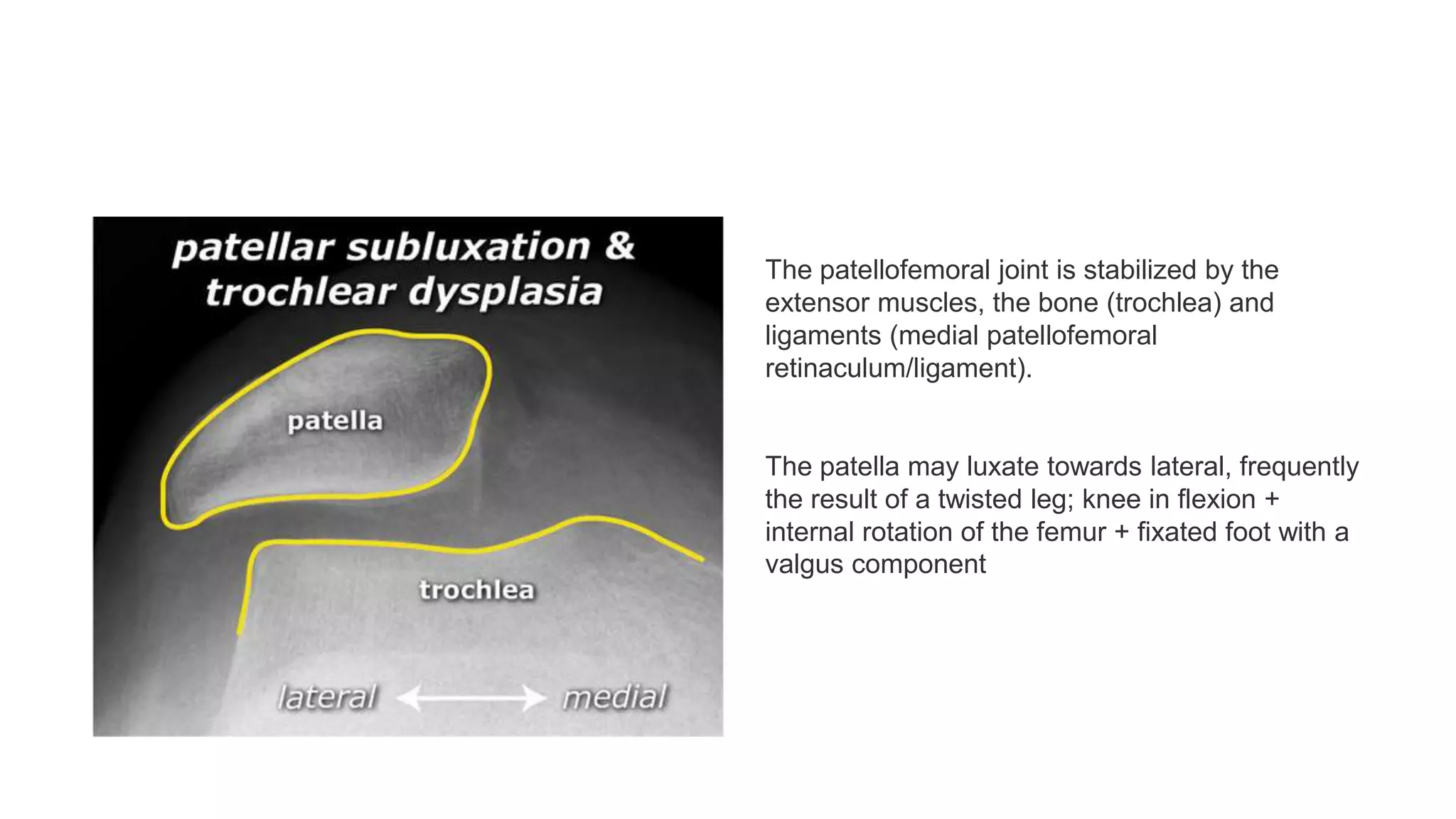 X Ray and MRI of Knee Joint | PPTX