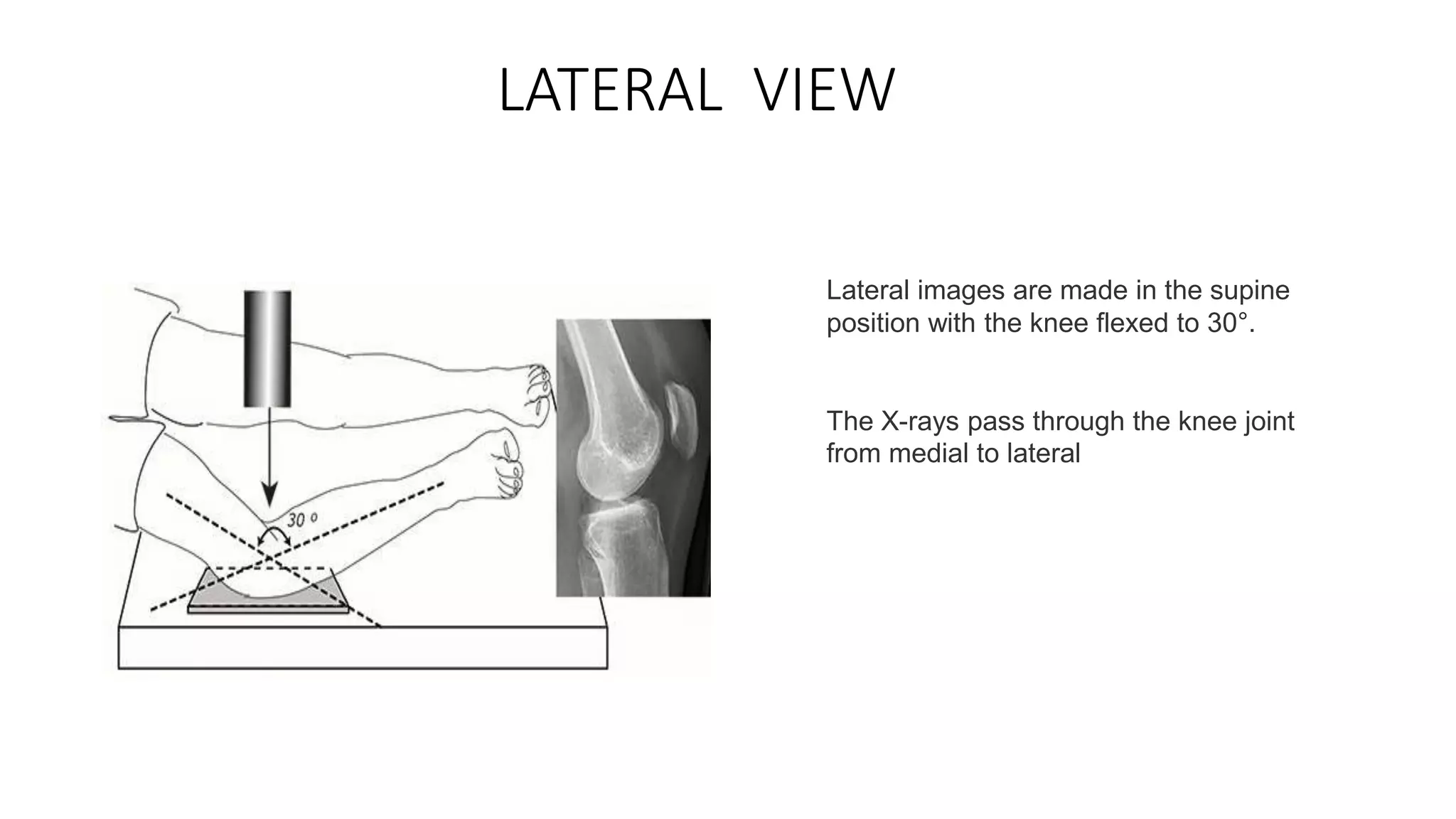 X Ray and MRI of Knee Joint | PPTX