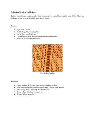 Study on Different Types of Knitting Faults, Causes and Remedies of ...