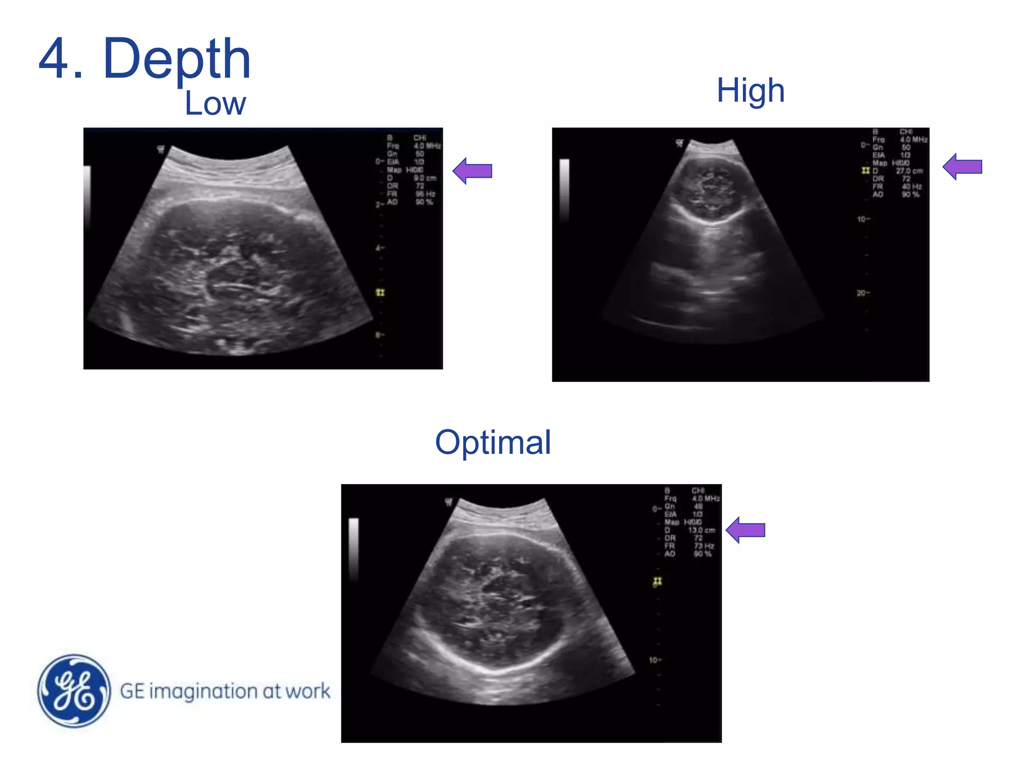 Ultrasound Basic Knobology & Controls | PPTX