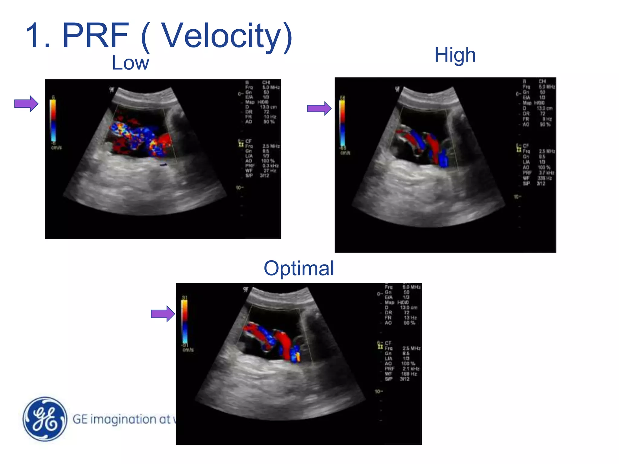 Ultrasound Basic Knobology & Controls | PPTX
