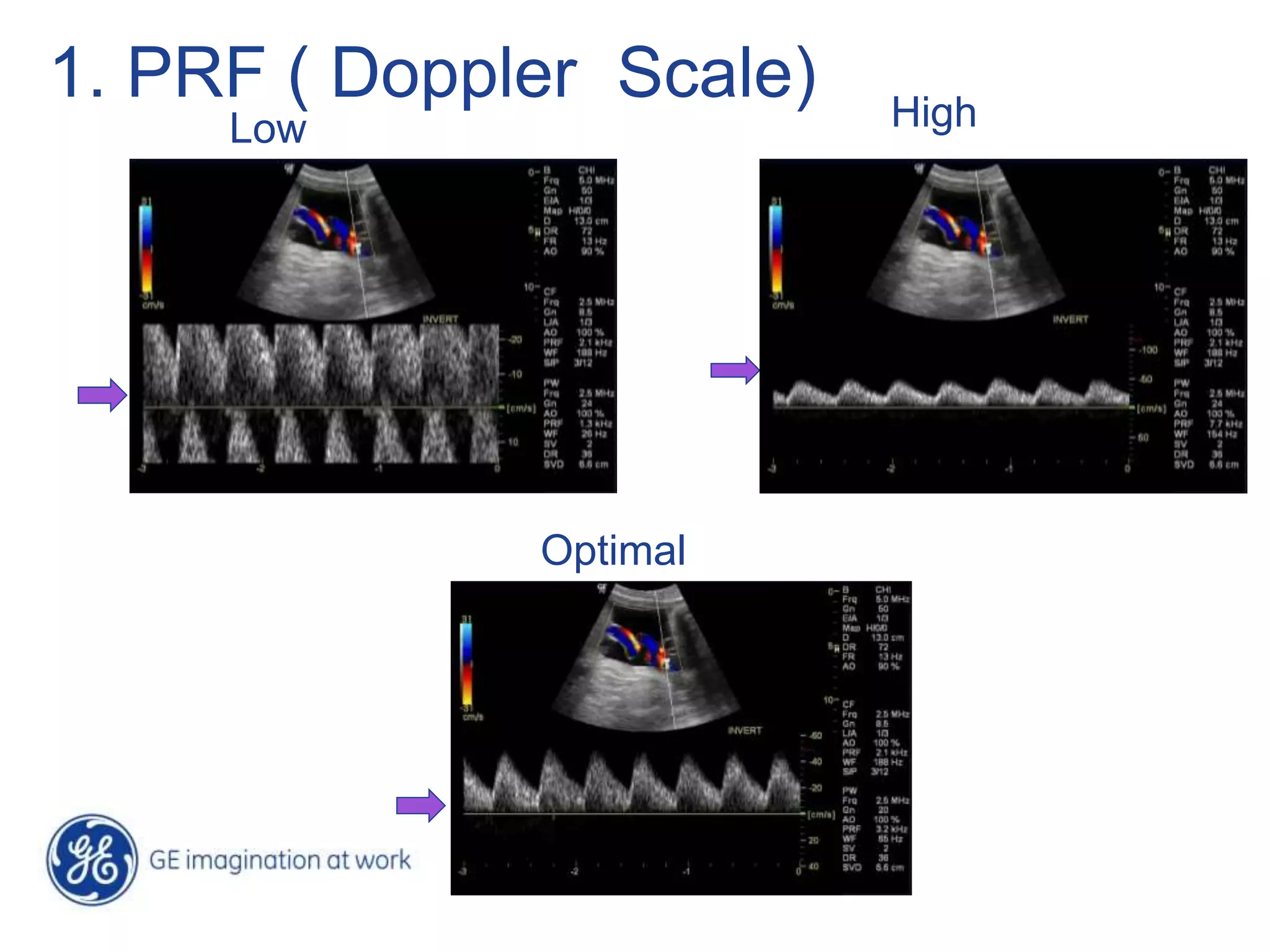 Ultrasound Basic Knobology & Controls | PPTX