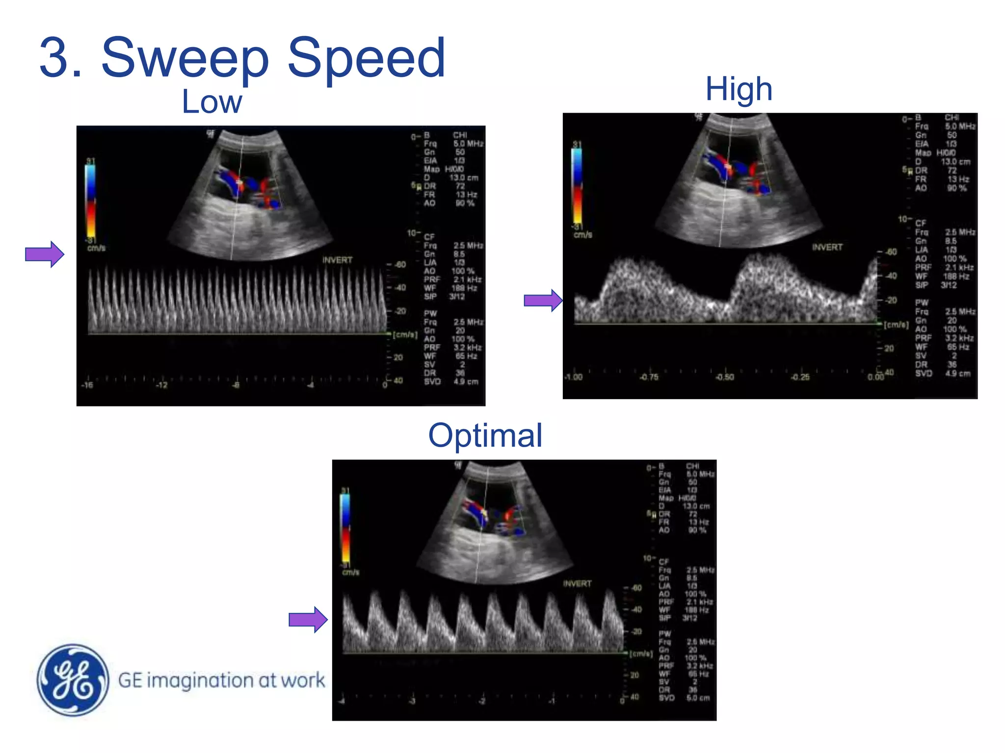 Ultrasound Basic Knobology & Controls | PPTX