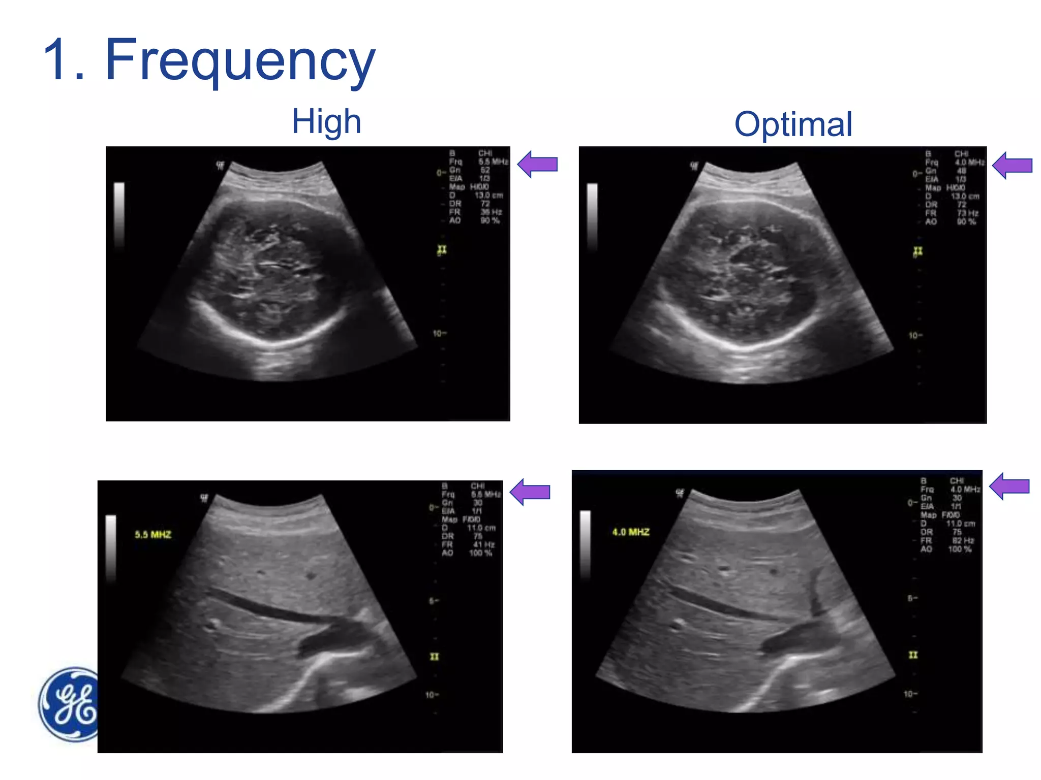 Ultrasound Basic Knobology & Controls | PPTX