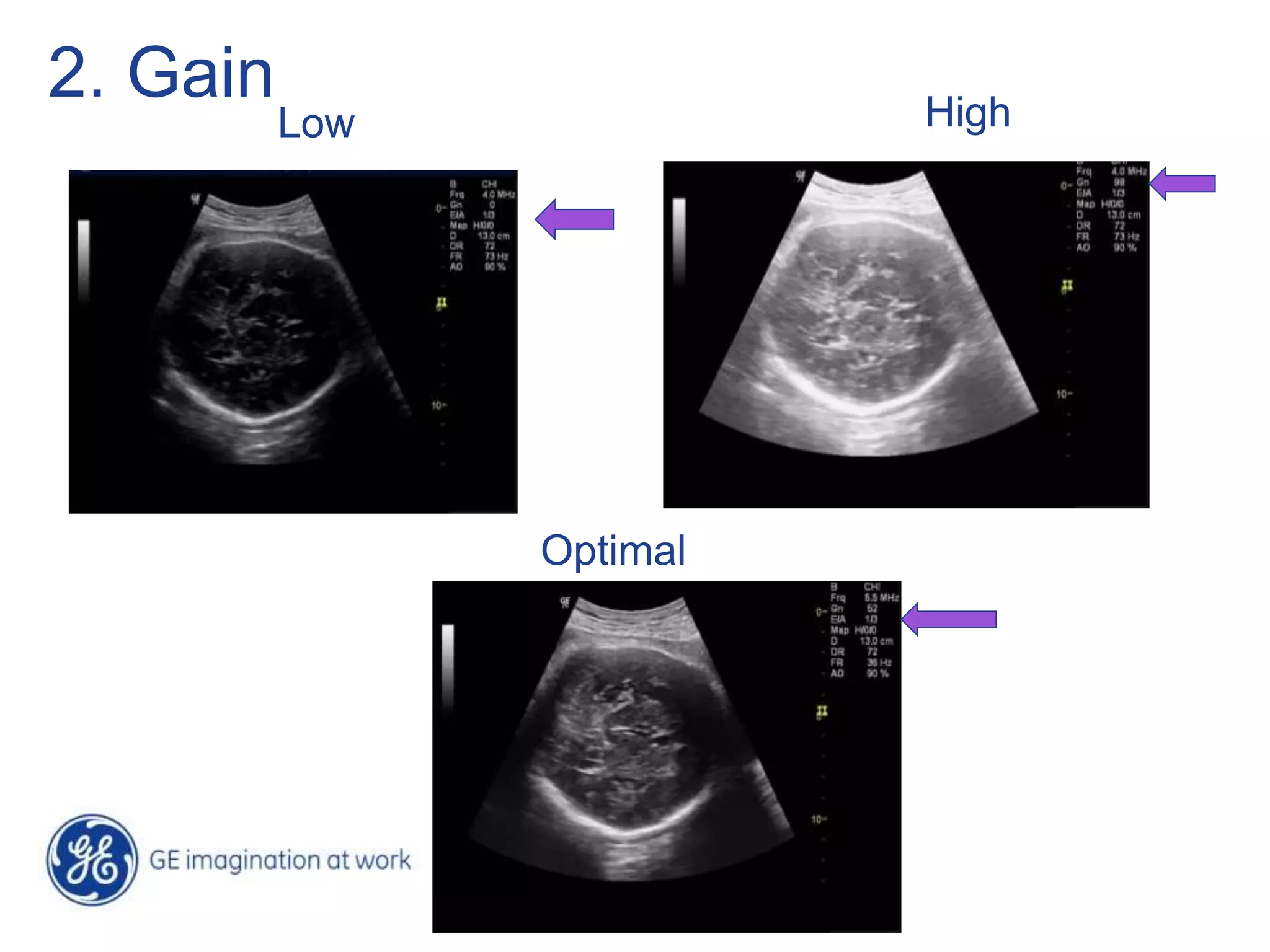Ultrasound Basic Knobology & Controls | PPTX