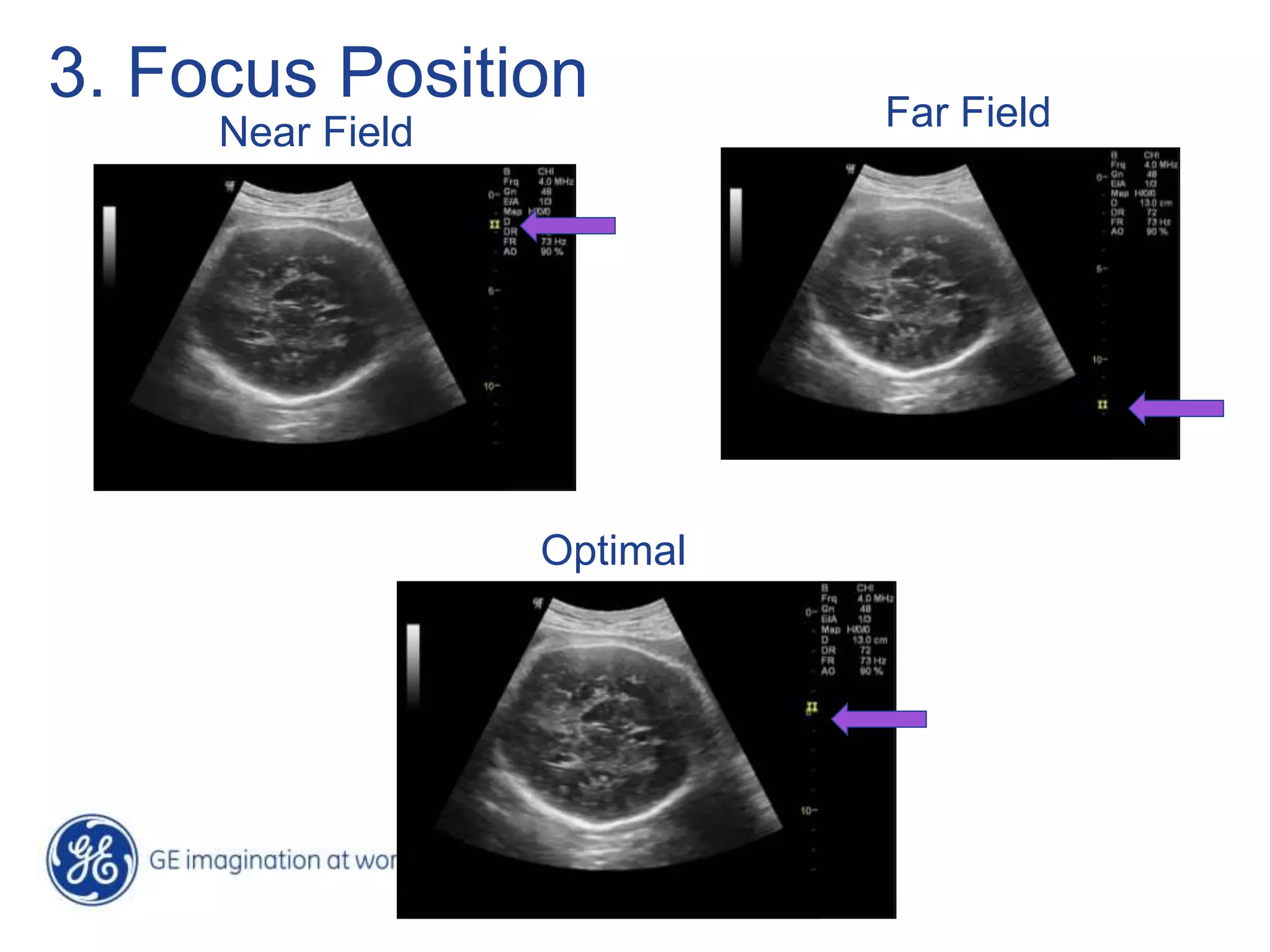 Ultrasound Basic Knobology & Controls | PPTX