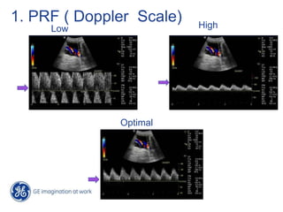 Ultrasound Basic Knobology & Controls | PPTX
