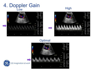 Ultrasound Basic Knobology & Controls | PPTX
