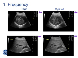 Ultrasound Basic Knobology & Controls | PPTX