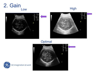 Ultrasound Basic Knobology & Controls | PPTX